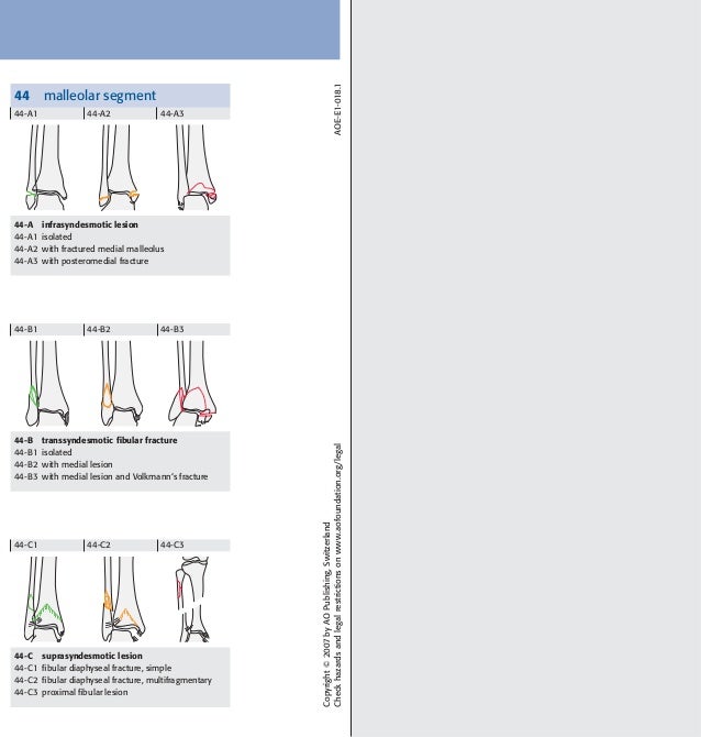 MULLER AO CLASSIFICATION