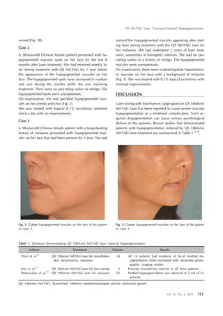 Laser-induced hypopigmentation | PDF