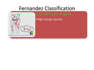 conference extern orthopedic | PPT
