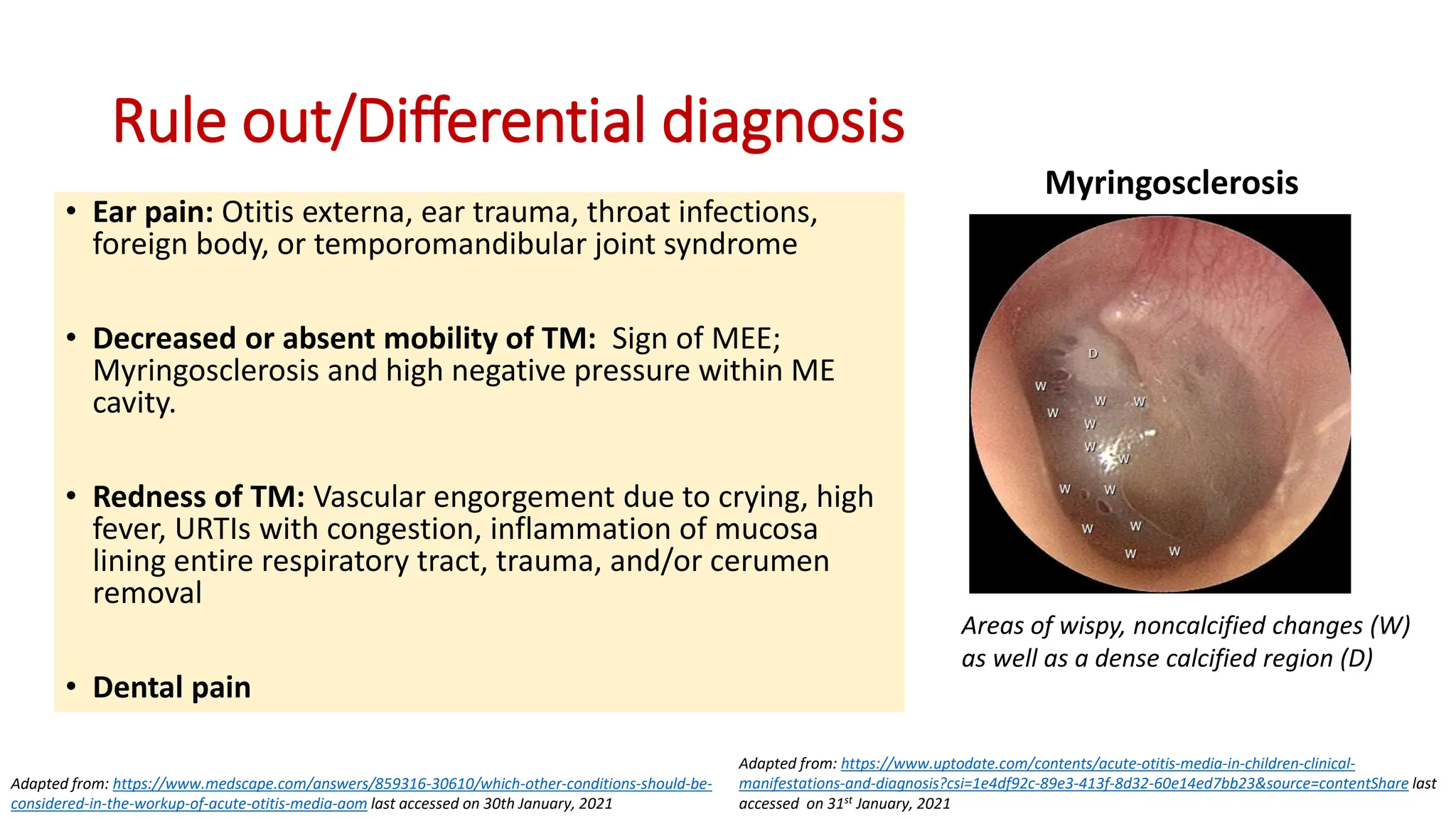 ACUTE OTITIS MEDIA IN CHILDREN cme SLIDE SET | PPTX