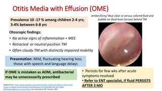 ACUTE OTITIS MEDIA IN CHILDREN cme SLIDE SET | PPTX
