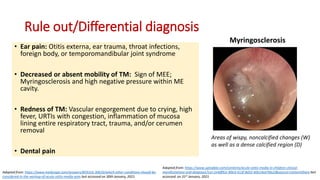 ACUTE OTITIS MEDIA IN CHILDREN cme SLIDE SET | PPTX