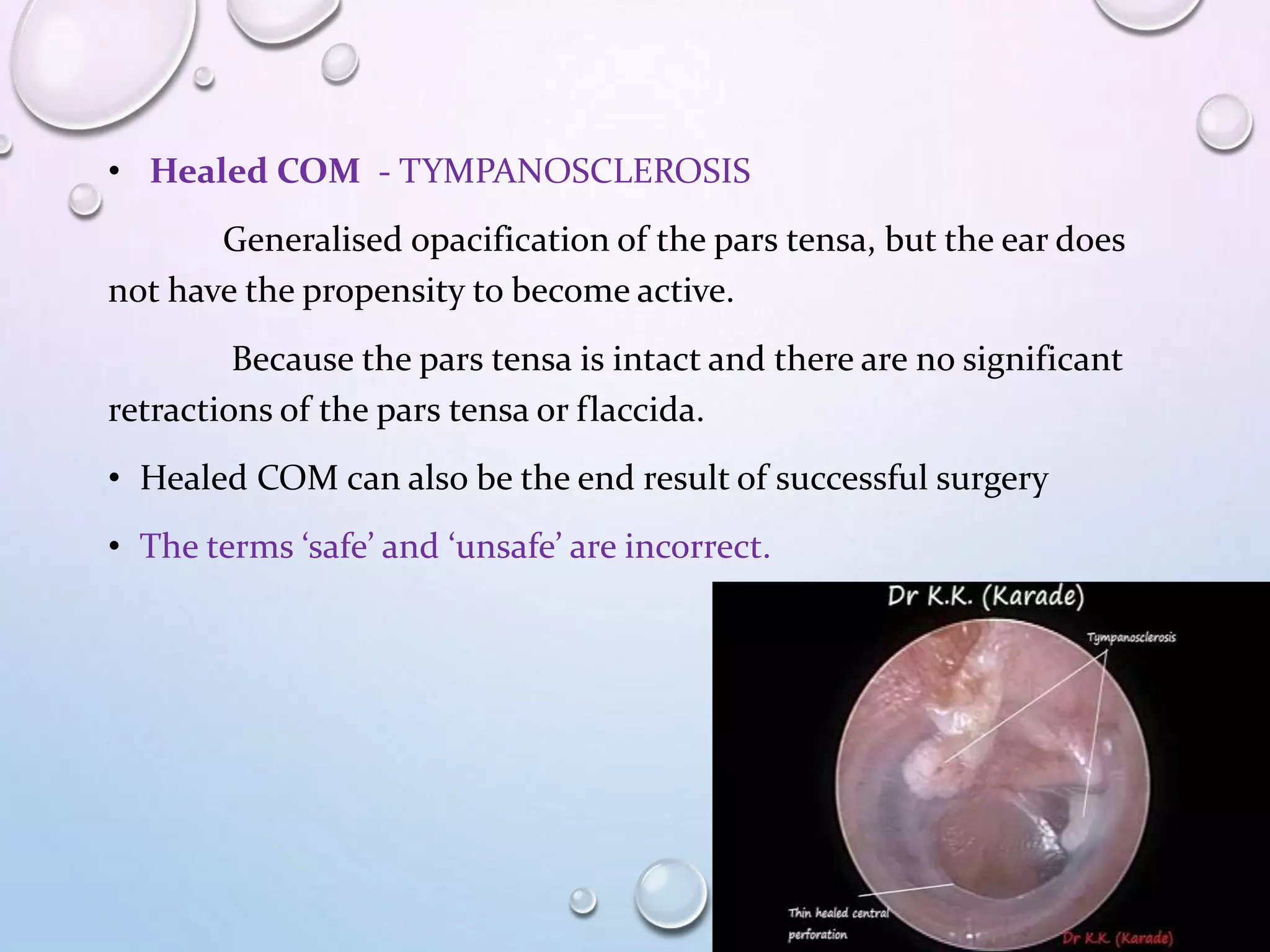 Aom,ome,com copy | PPTX | Ear, Nose and Throat Conditions | Diseases and Conditions