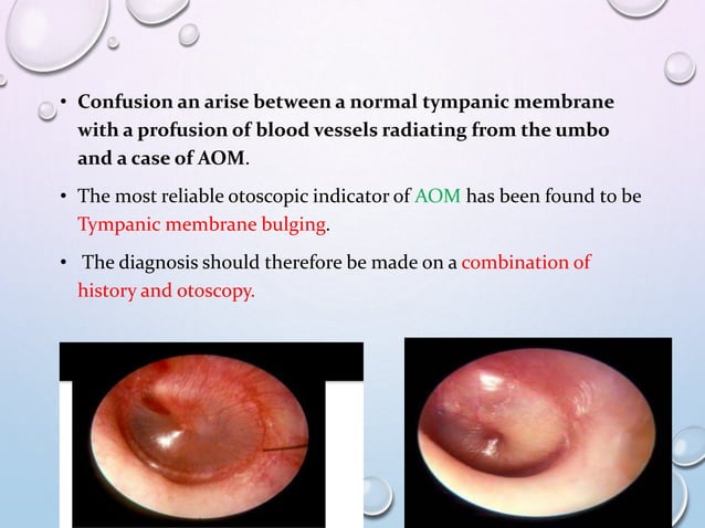 Aom,ome,com copy | PPT