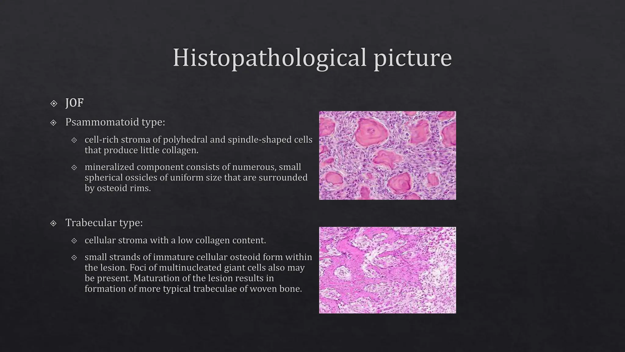 fibro-osseous lesions of maxillofacial region | PPTX