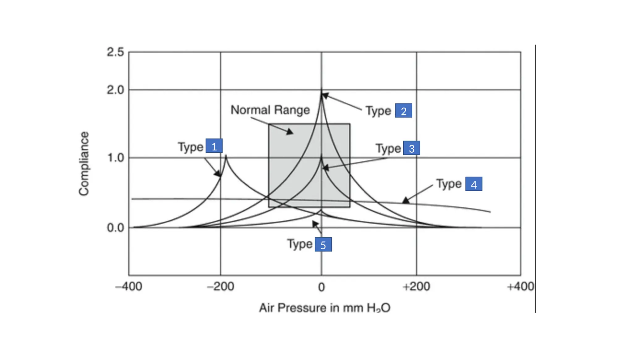 Acute Otitis Media (AOM) UG-ENT MBBS.pptx | Ear, Nose and Throat ...