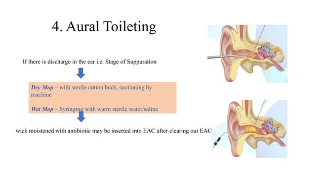 Acute Otitis Media (AOM) UG-ENT MBBS.pptx | Ear, Nose and Throat ...
