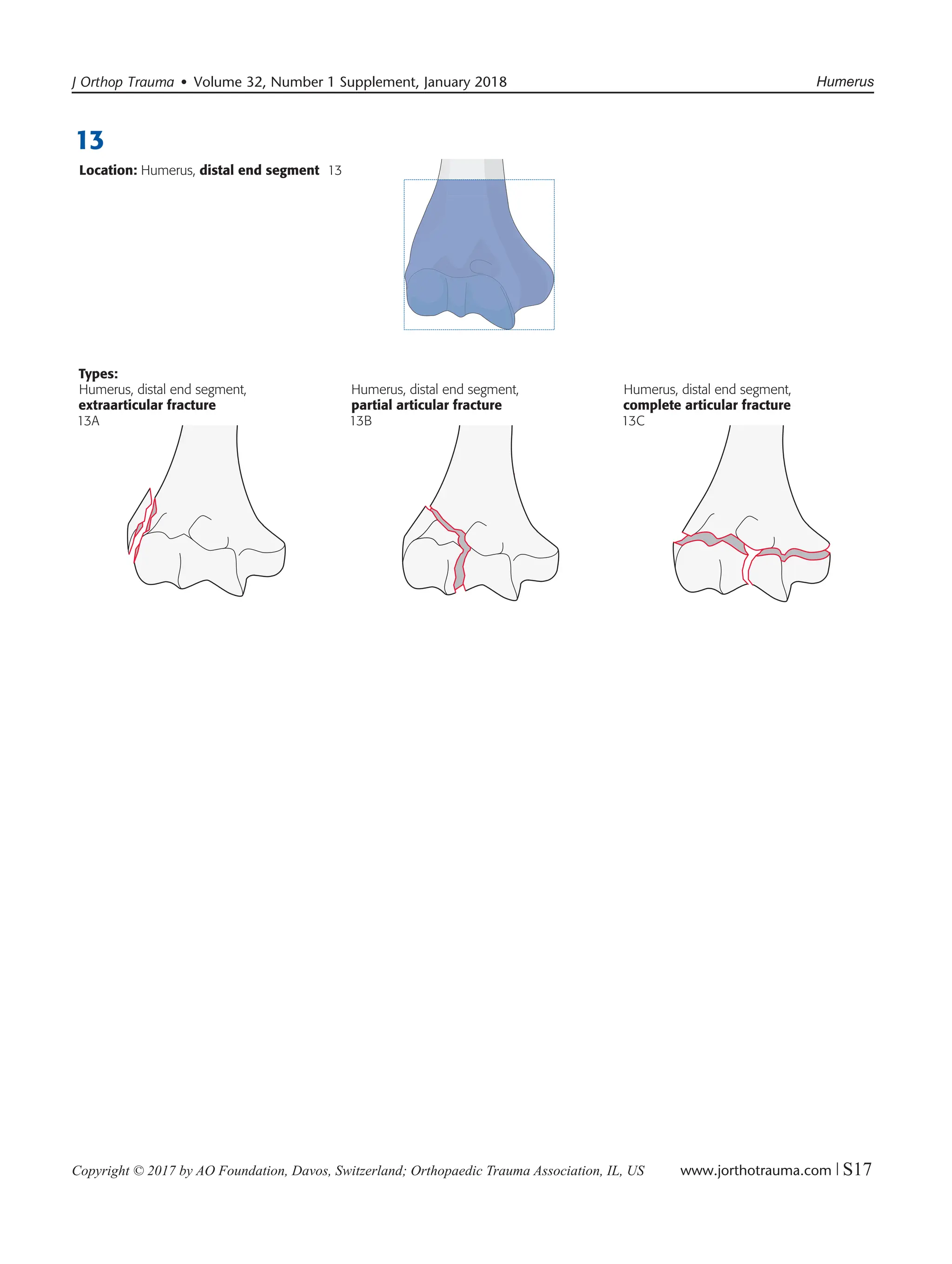 AOOTA_Classification_2018_Compendium clasificacion ao de fracturas en ...