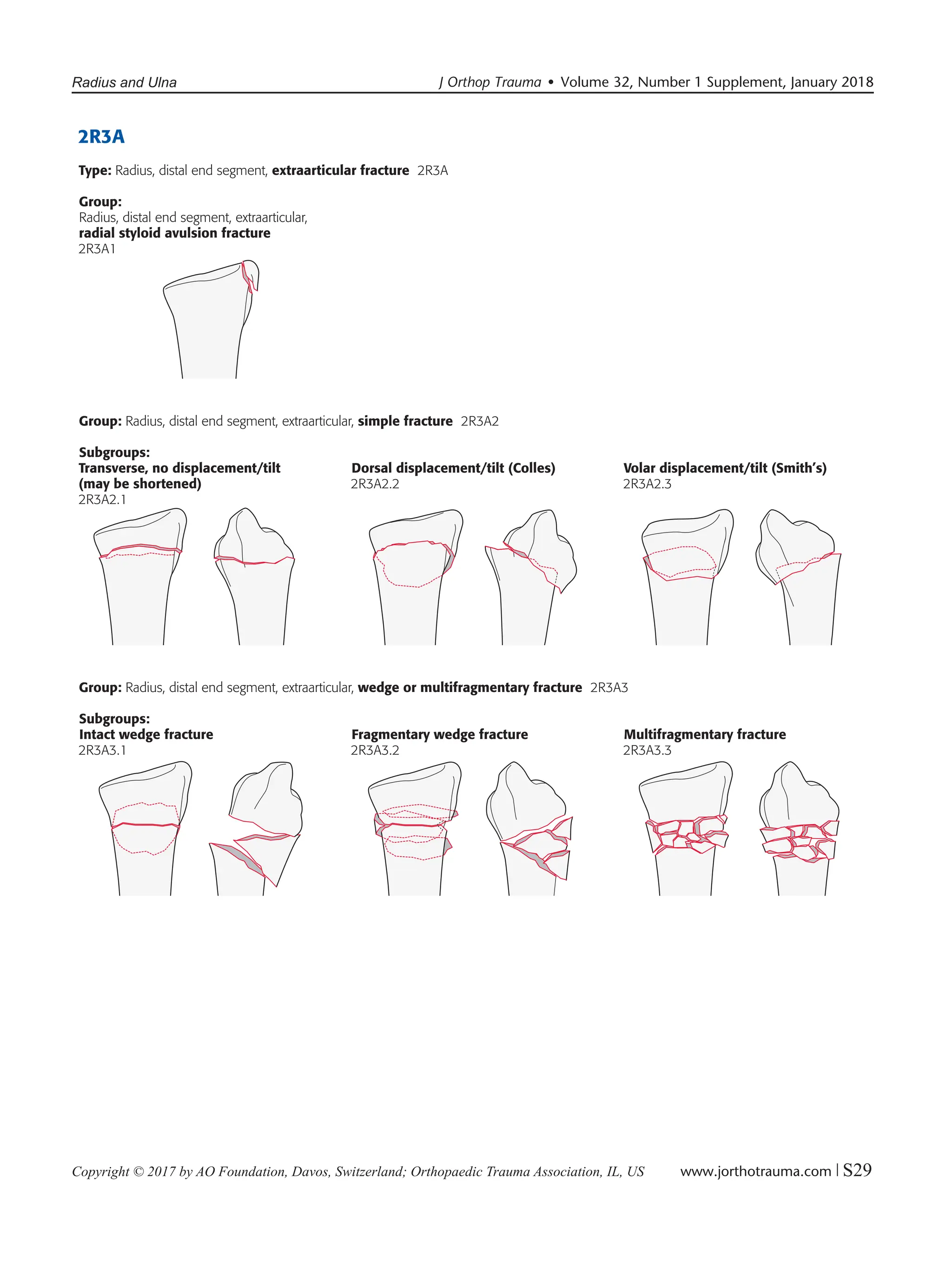 AOOTA_Classification_2018_Compendium clasificacion ao de fracturas en ...