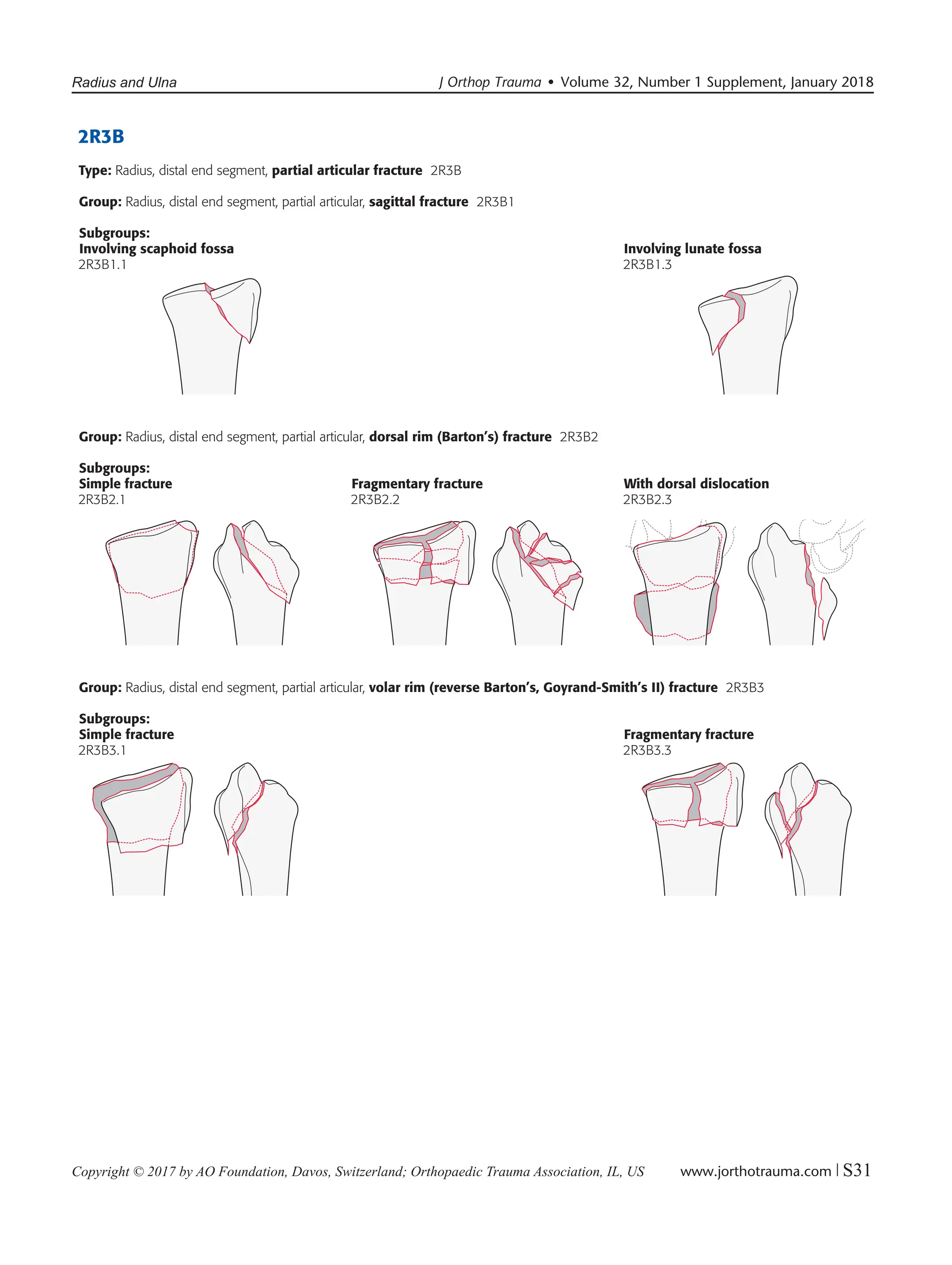 AOOTA_Classification_2018_Compendium clasificacion ao de fracturas en ...