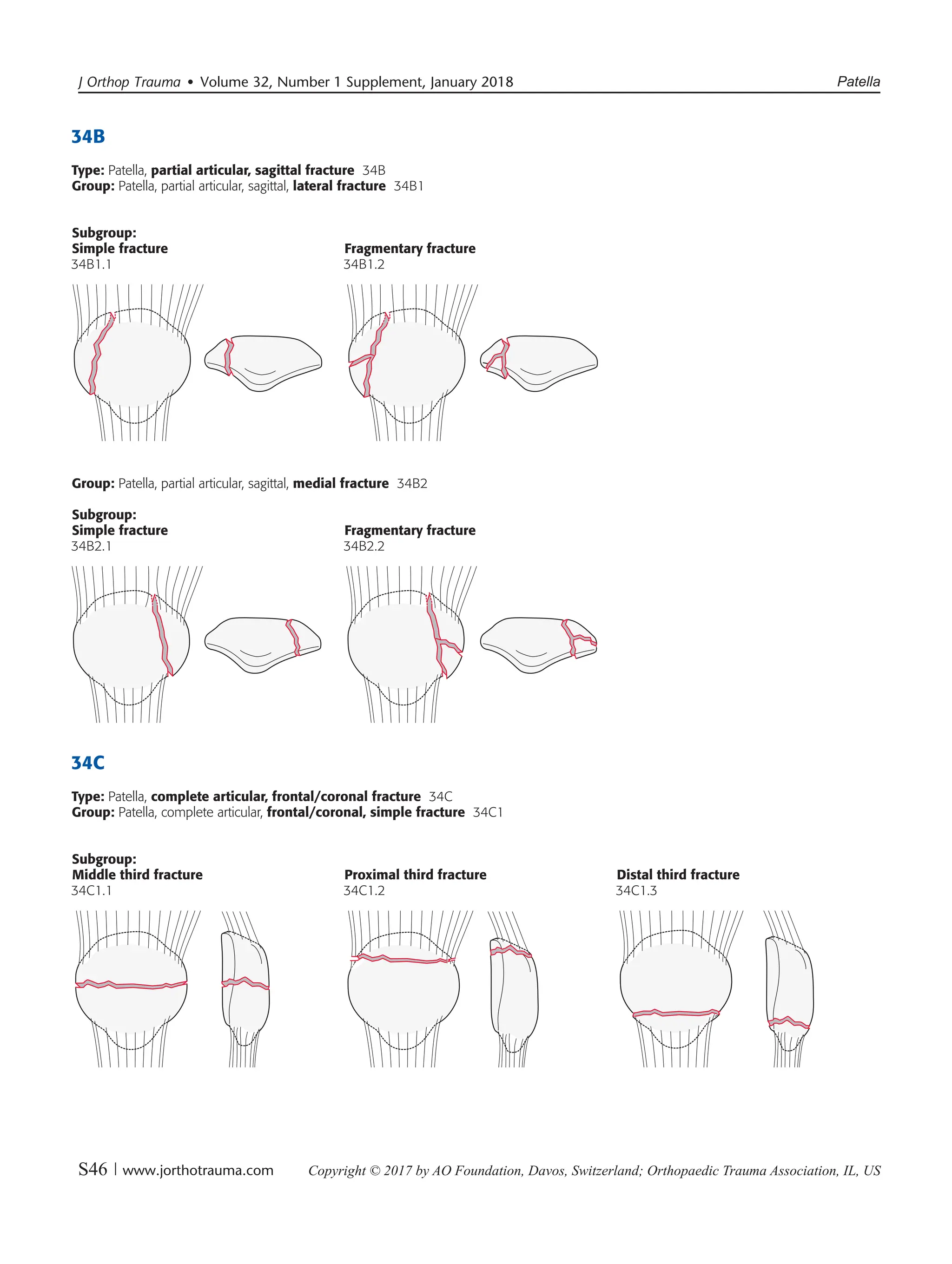 AOOTA_Classification_2018_Compendium clasificacion ao de fracturas en ...