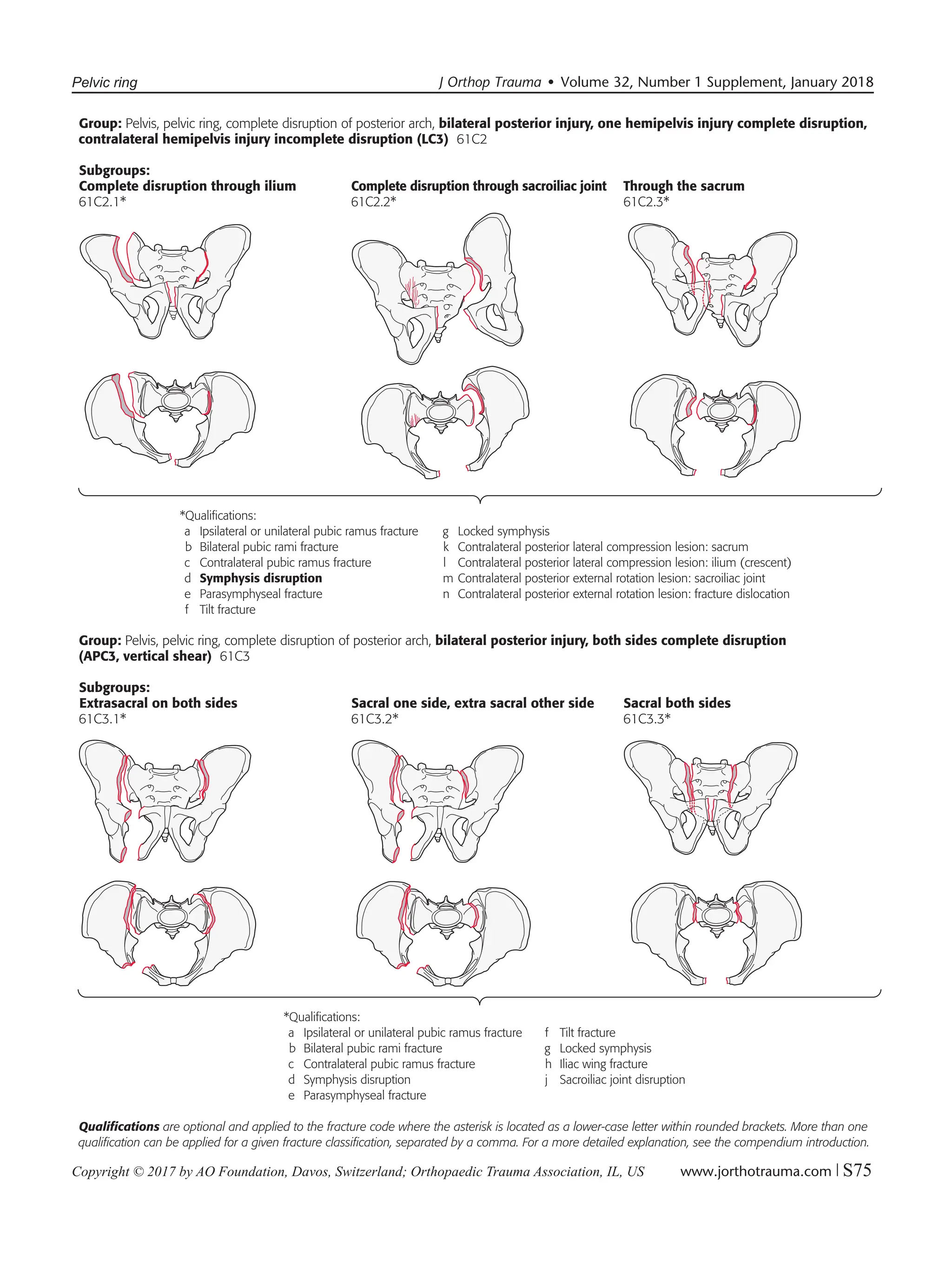 AOOTA_Classification_2018_Compendium clasificacion ao de fracturas en traumatologia y ortopedia.pdf