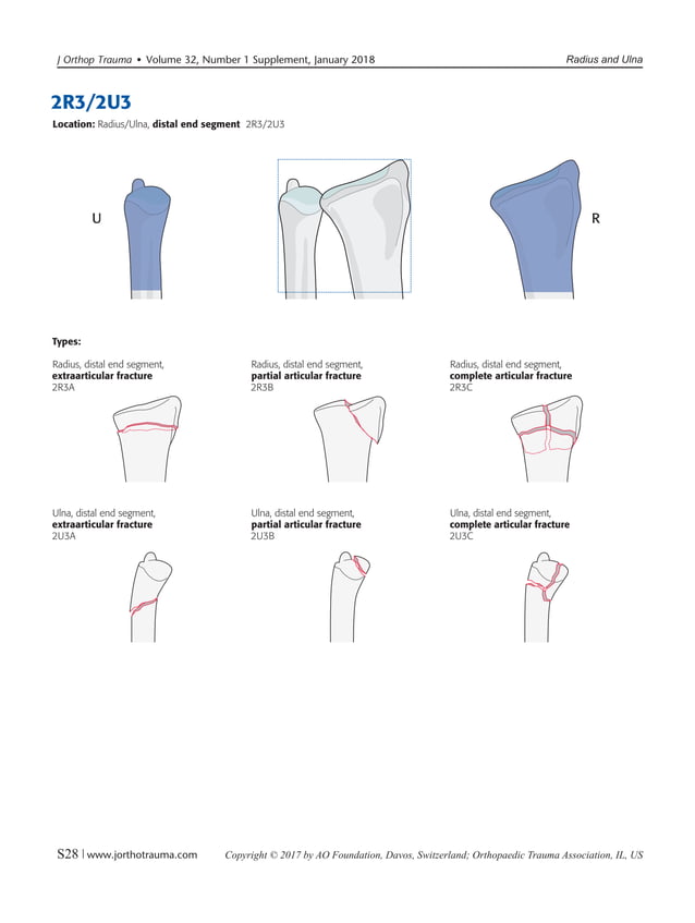 AOOTA_Classification_2018_Compendium clasificacion ao de fracturas en ...