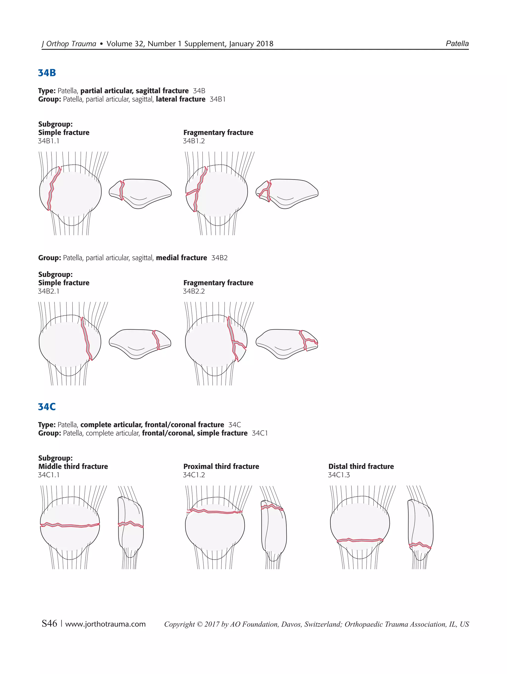 AOOTA Classification Compendium 2018.pdf
