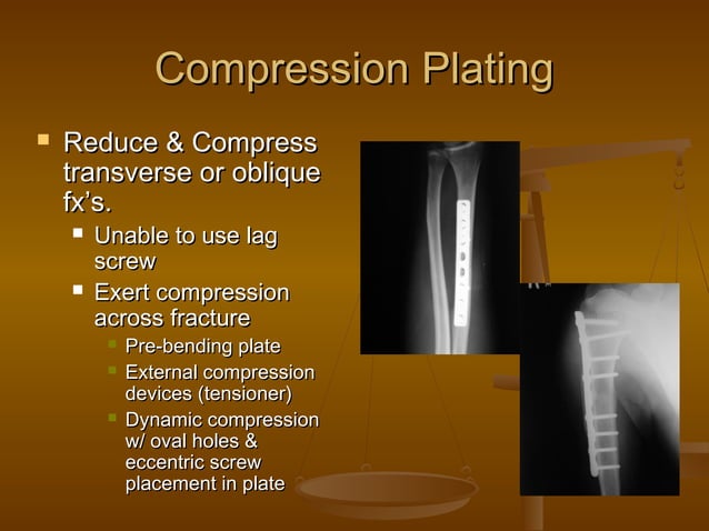 AO Principles of Fracture treatment & Different Implants. | PPT