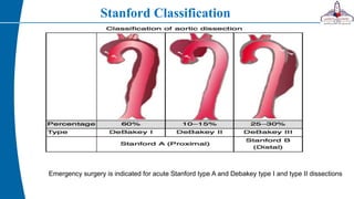 Introduction to aortic surgery | PPTX