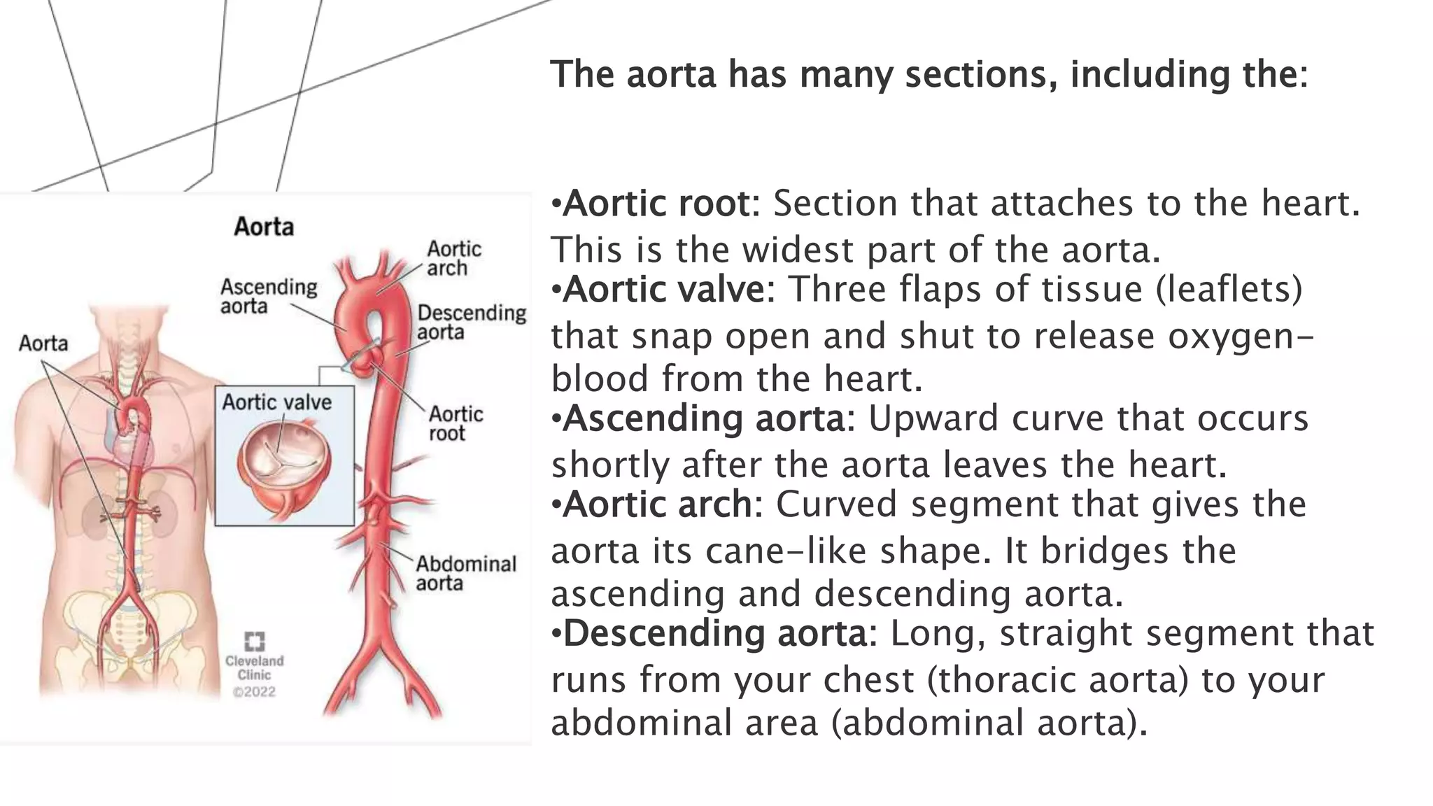Aorta.pptx