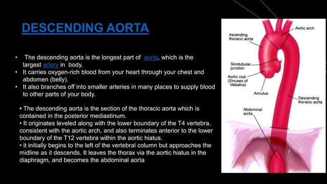 Aorta.pptx