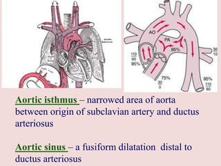 AORTA 2.pptx