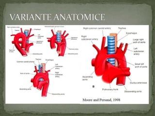 Anatomia Aortei | PPTX