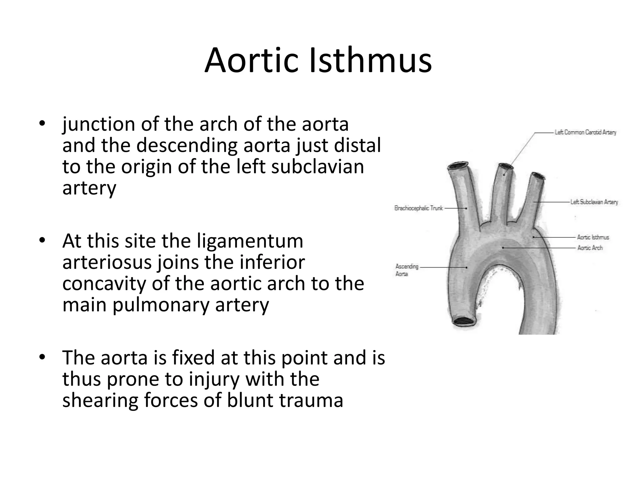 Aorta: anatomy and congenital anomalies | PPTX