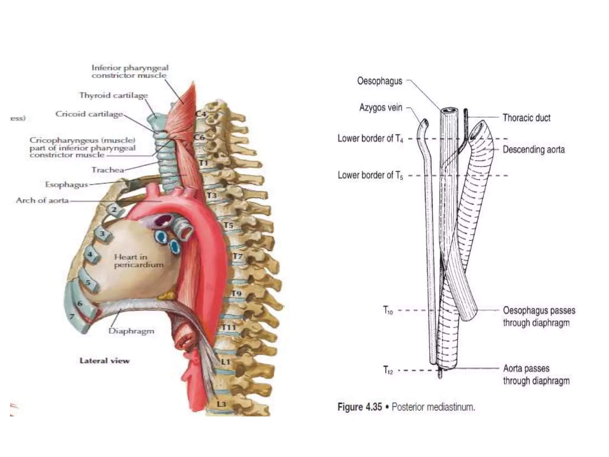 Aorta: anatomy and congenital anomalies | PPTX