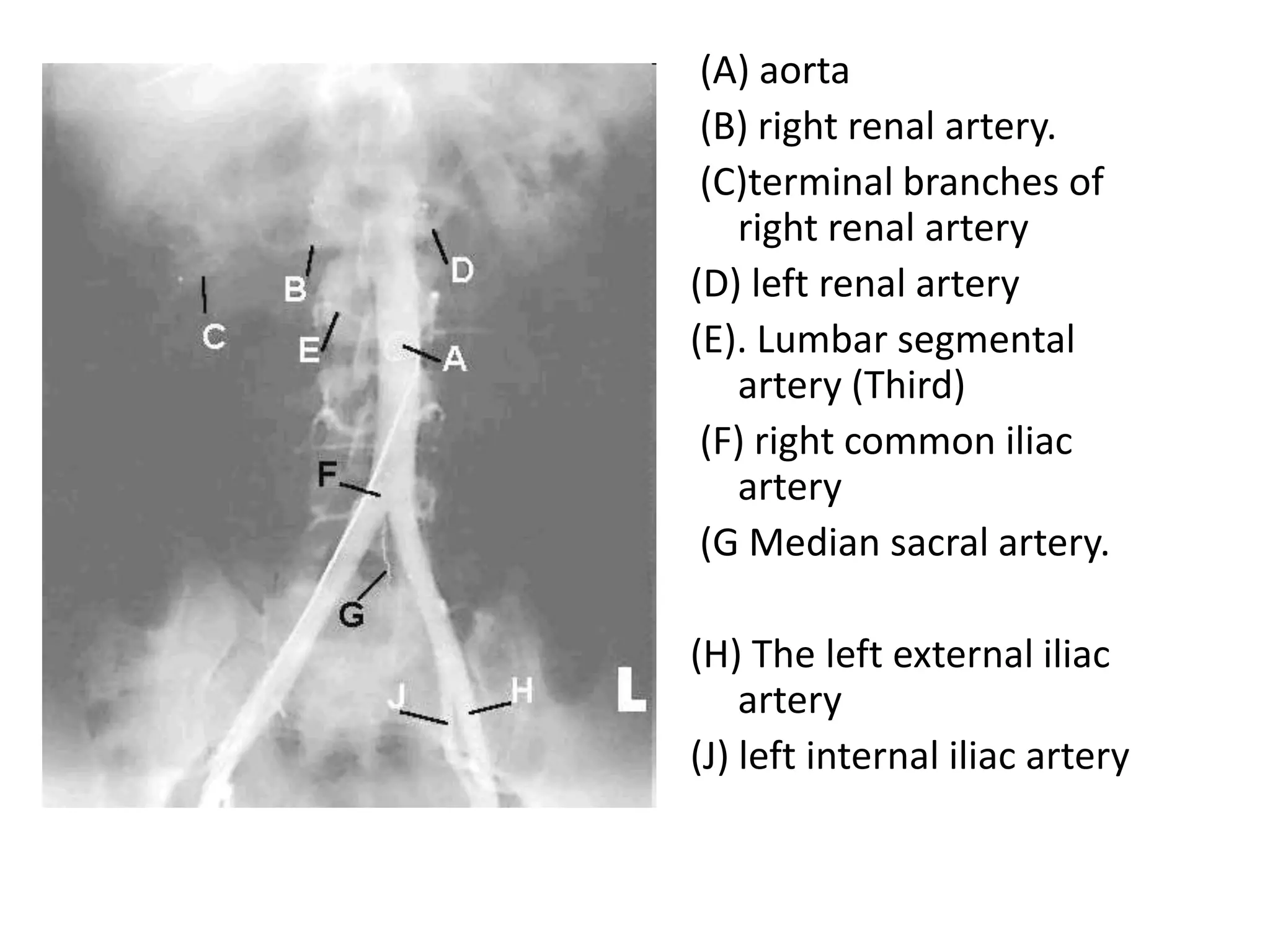 Aorta: anatomy and congenital anomalies | PPTX