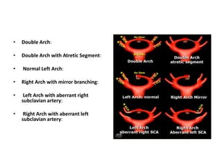 Aorta: anatomy and congenital anomalies | PPTX