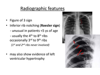 Aorta: anatomy and congenital anomalies | PPTX