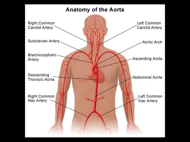 Aorta intro | PPT | Heart and Cardiovascular Diseases | Diseases and Conditions