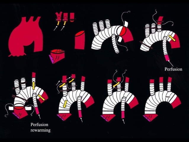 Aorta intro | PPT