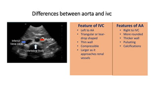 aorta & ivc-compressed pocus slides Malaysia | PDF