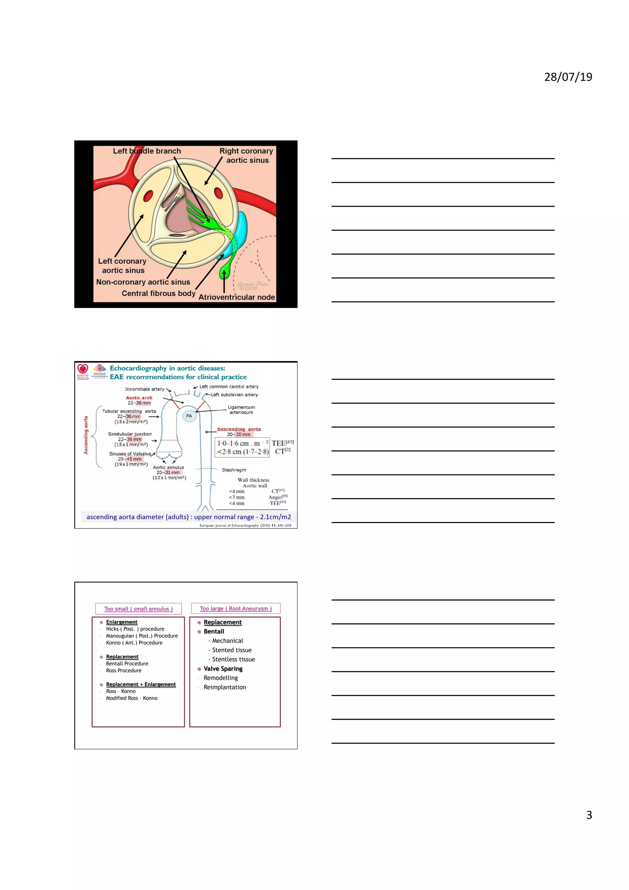 Aortic Root SUrgery | PDF