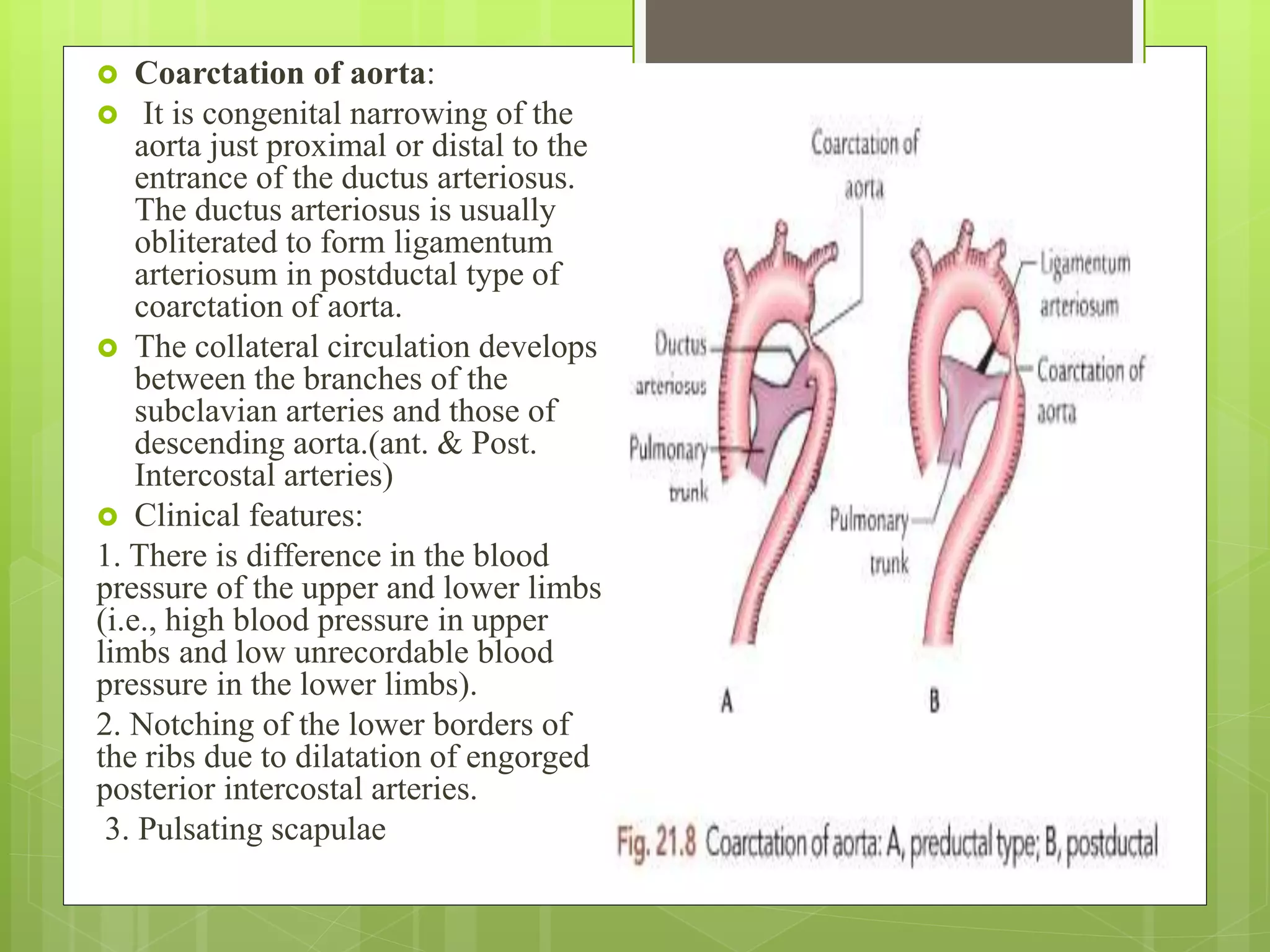 Aorta, SVC, PULMONARY TRUNK.pptx