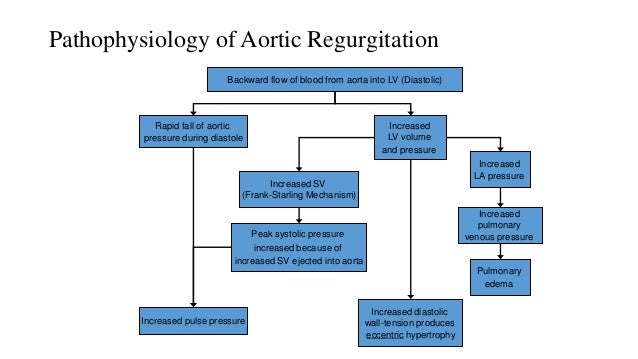 Anesthesia Management in Aortic Regurgitation