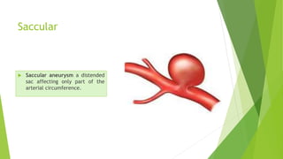Aortic aneurysm | PPSX