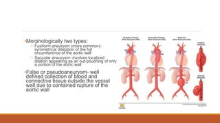 AORTIC ANEURYSM.pptx
