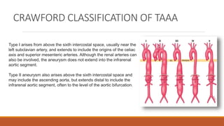 AORTIC ANEURYSM.pptx