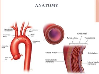 Aortic aneurysm basic, types and management | PPT