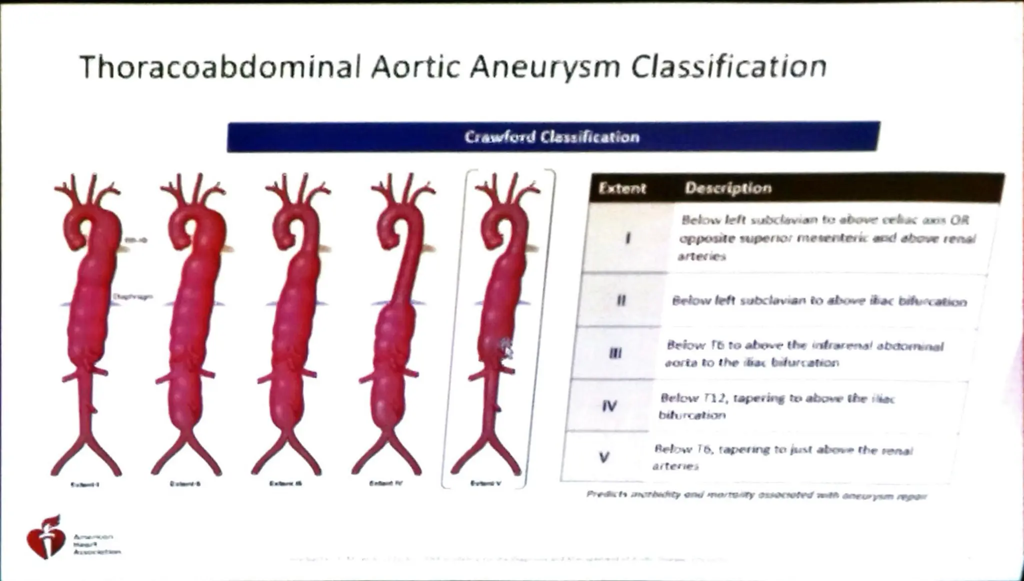 Aortic aneurysm Arnab choudhary D sir.pdf
