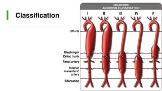 Aortic Aneurysm.pdf