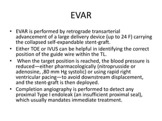 Aortic aneurysm final | PPTX