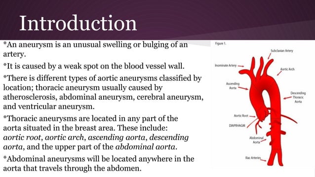 Aortic Aneurysm detailed explanation pptx | PPT