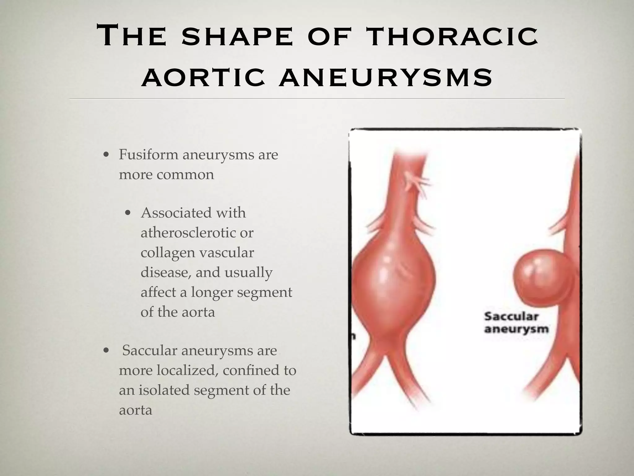Aortic aneurysms and dissection 2016 | PDF