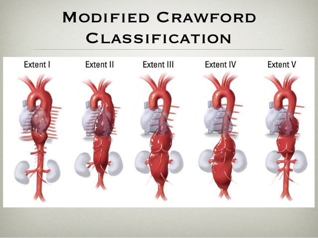 Aortic aneurysms and dissection 2016