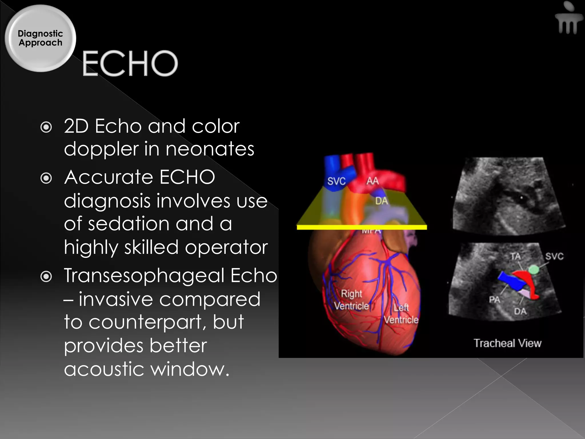 Aortic arch anomalies | PDF