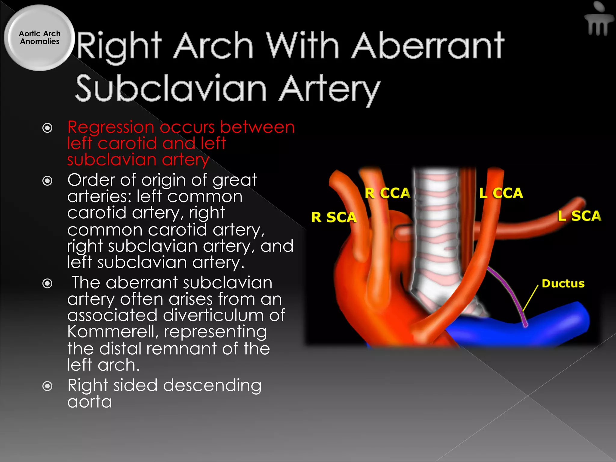 Aortic arch anomalies | PDF
