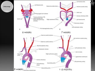 Aortic arch anomalies | PDF