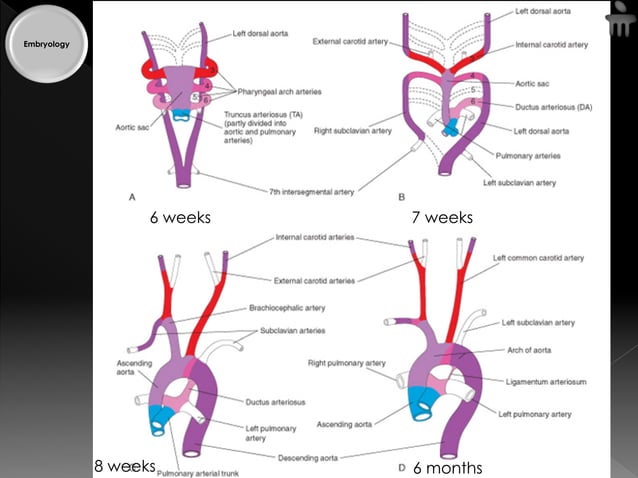 Aortic arch anomalies | PDF