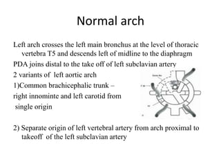 Aortic arch anomalies | PPTX